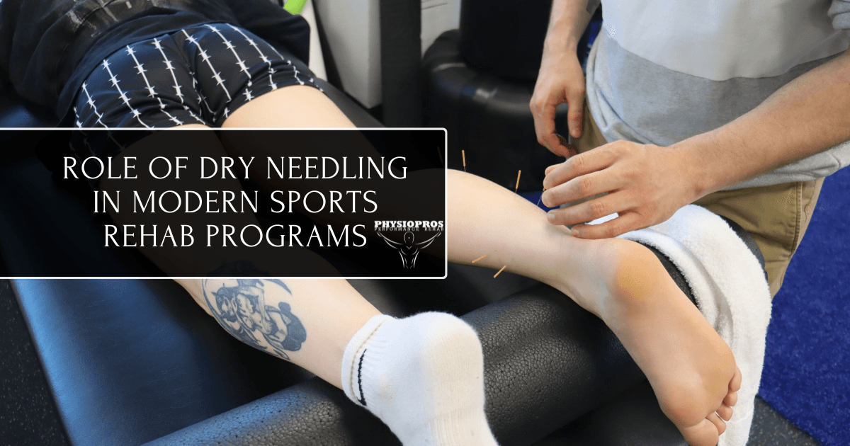 The Role of Dry Needling in Modern Sports Rehab Programs